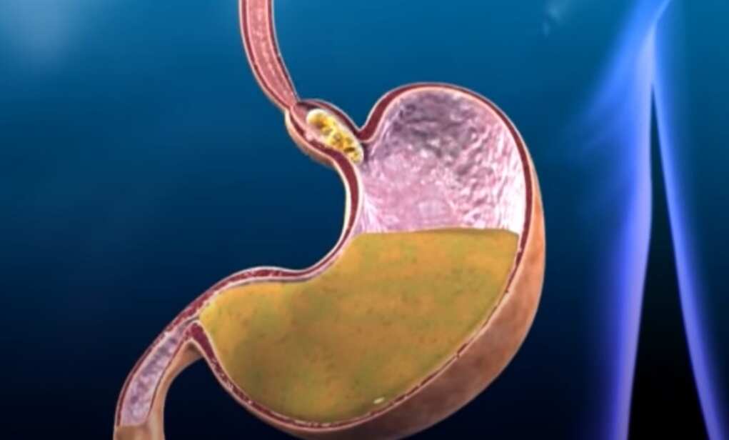 Myth or Fact: Human Body | Amaze Trivia